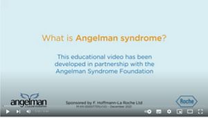 Clinical Trial – Angelman Syndrome – Safety, Pharmacokineti...